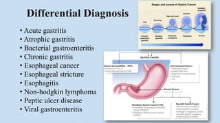 Esophageal & gastric cancers | PPTX