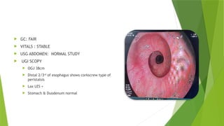 ESOPHAGEAL GASTRIC MOTILITY DISORDER.pptx