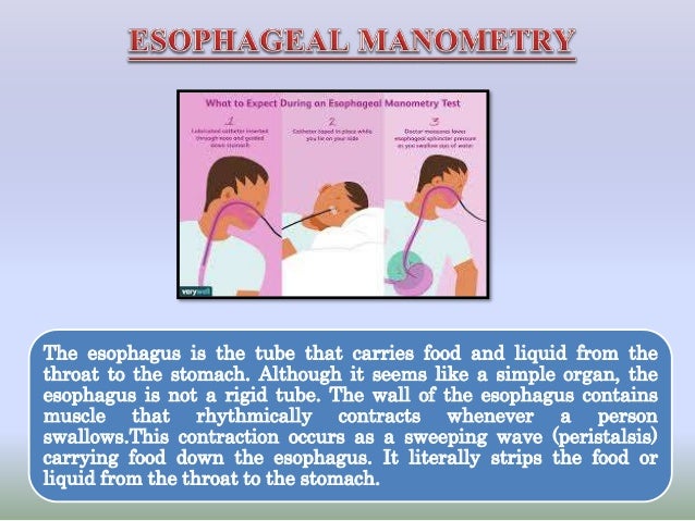 Esophageal manometry