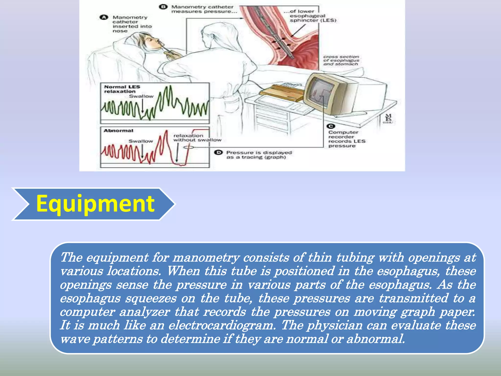 Esophageal manometry | PPTX