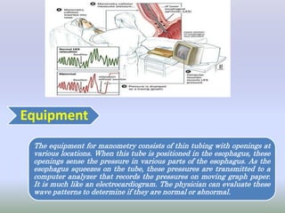 Esophageal manometry | PPTX