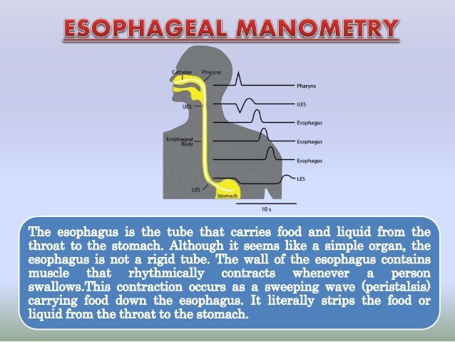 Esophageal manometry