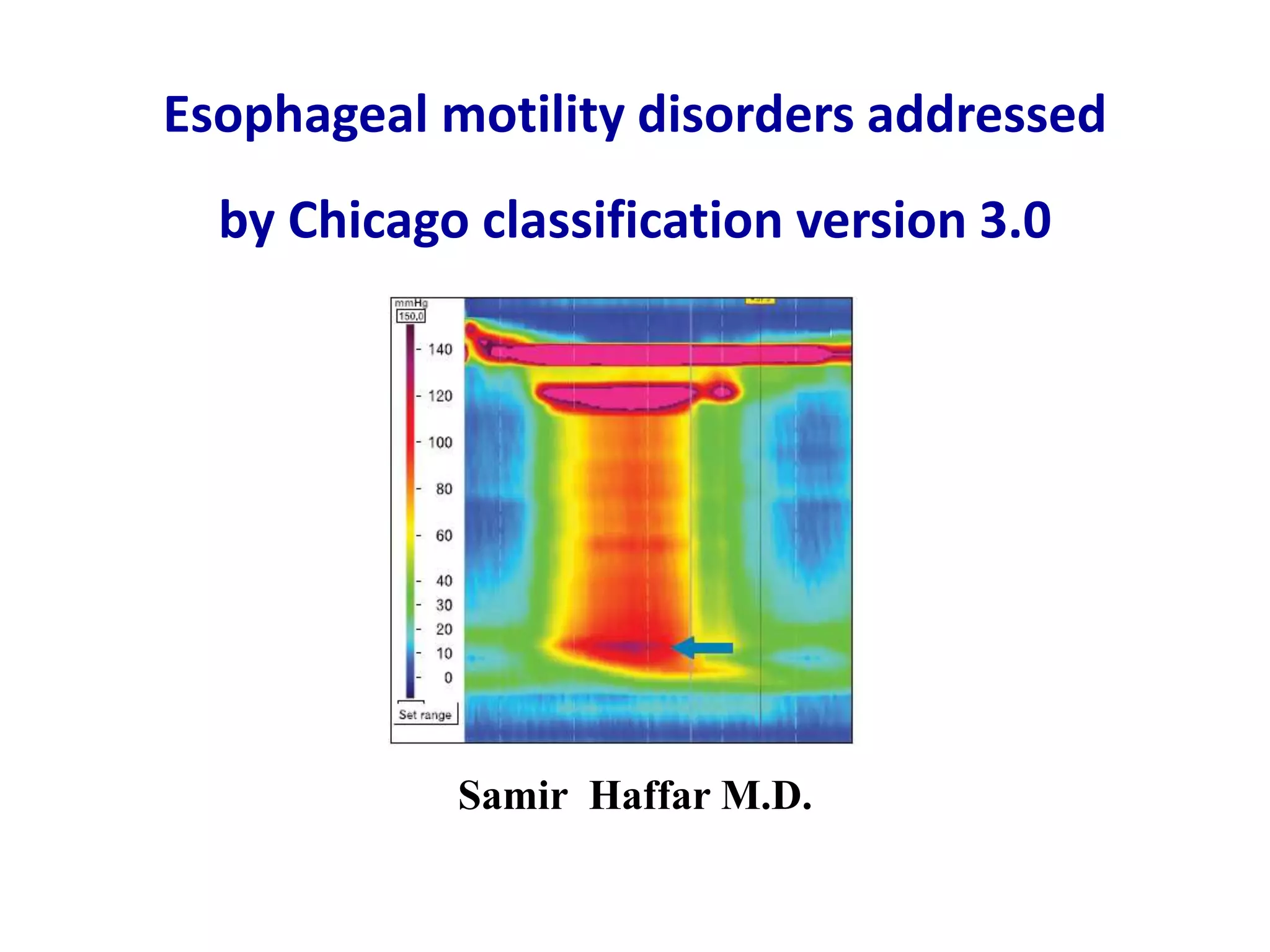 Esophageal motility disorders in Chicago classification v3.0 | PPTX