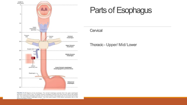 Esophageal motility disorders | PPTX | Digestive Disorders | Diseases ...