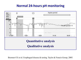 Esophageal pH monitoring in pediatrics | PPTX