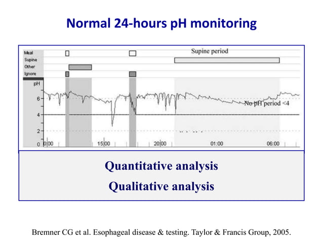 Esophageal pH monitoring in pediatrics | PPTX