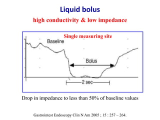 Esophageal pH monitoring in pediatrics | PPTX