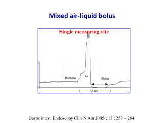 Esophageal pH monitoring in pediatrics | PPTX
