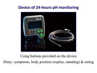 Esophageal pH monitoring in pediatrics | PPTX