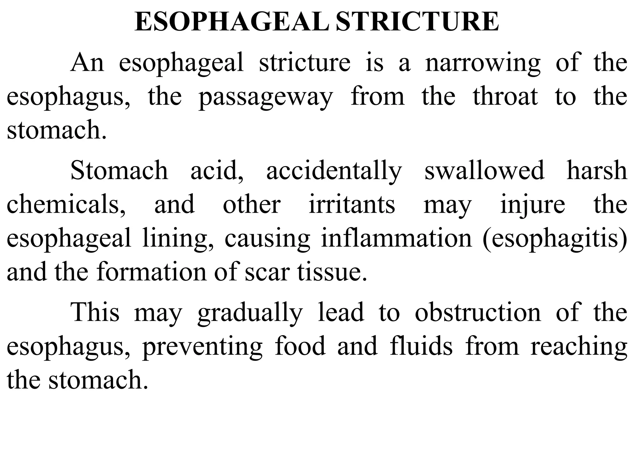 Esophageal stricture | PPTX