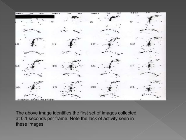 Esophageal transit imaging | PPTX | Digestive Disorders | Diseases and ...