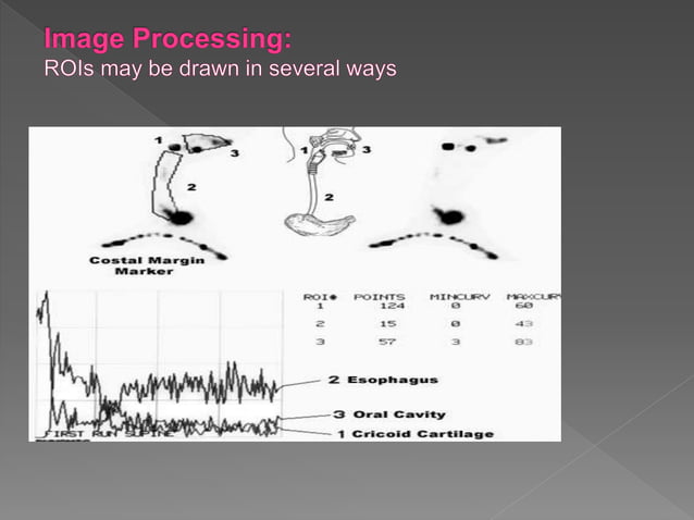 Esophageal transit imaging | PPTX | Digestive Disorders | Diseases and ...