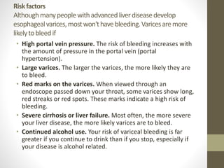 Esophageal varices | PPTX