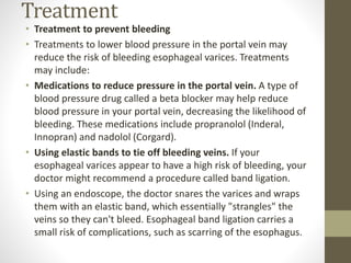 Esophageal varices | PPTX