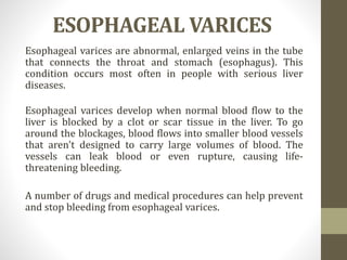 Esophageal Varices Rupture