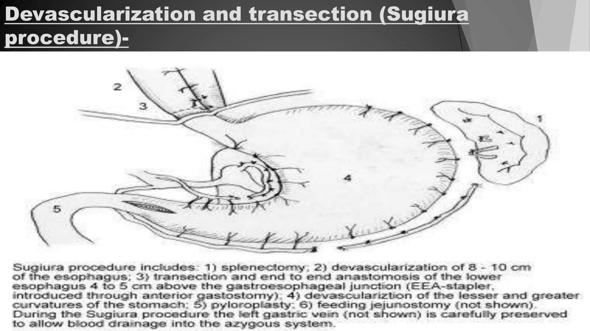 Esophageal varices and its management | PPTX