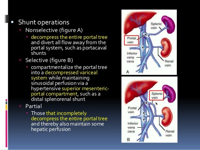 Esophageal varix surgical treatment