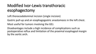Esophagectomy | PPTX