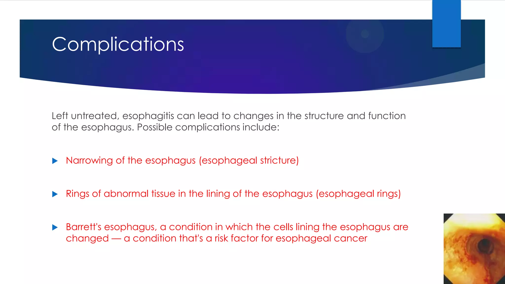 Esophagitis | PPTX