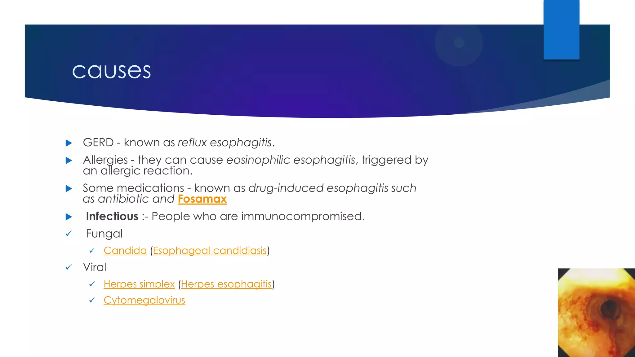 Esophagitis | PPTX