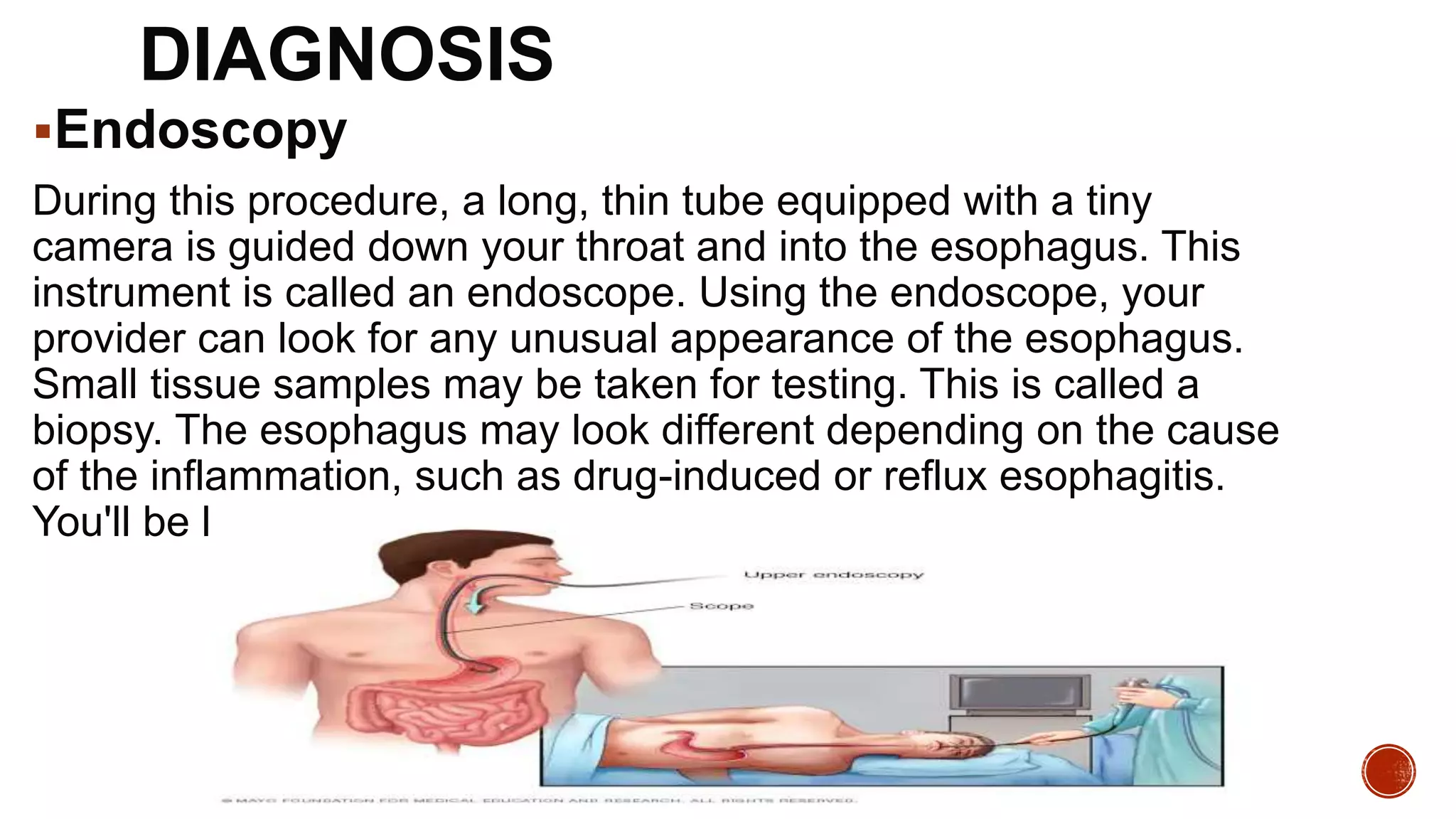Esophagitis.pptx