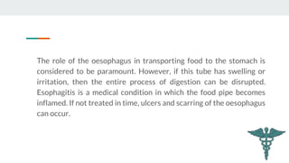 Esophagitis: Symptoms, Causes and Treatment | PPT