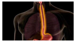 Esophagitis: Symptoms, Causes and Treatment | PPT