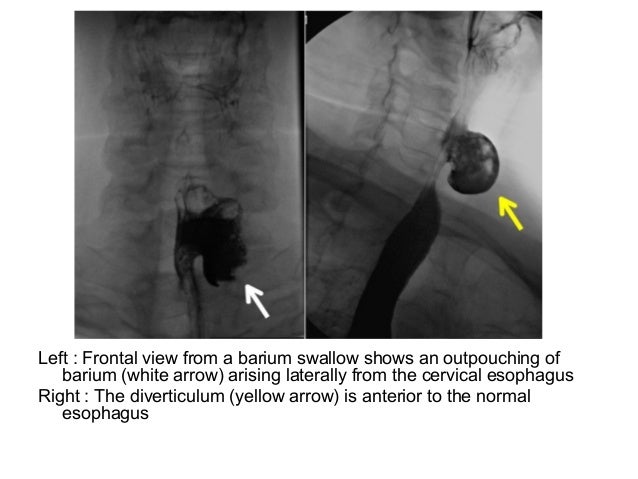 Diagnositc Imaging of the Esophagus