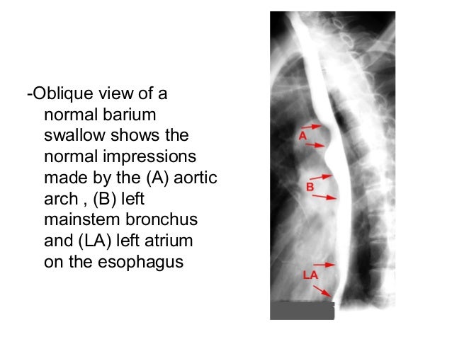 Diagnositc Imaging of the Esophagus