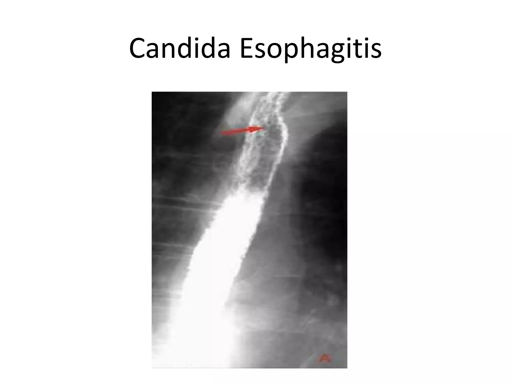 Esophagus diagnostic: modalities | PPTX