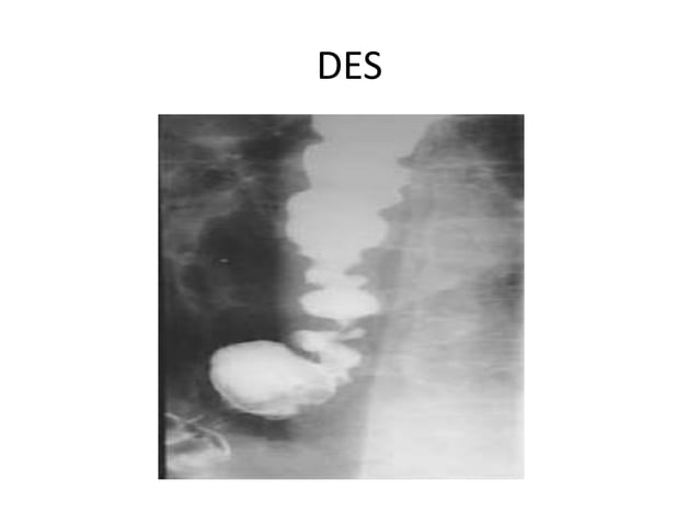 Esophagus diagnostic: modalities | PPTX | Digestive Disorders ...