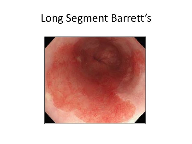 Esophagus diagnostic: modalities