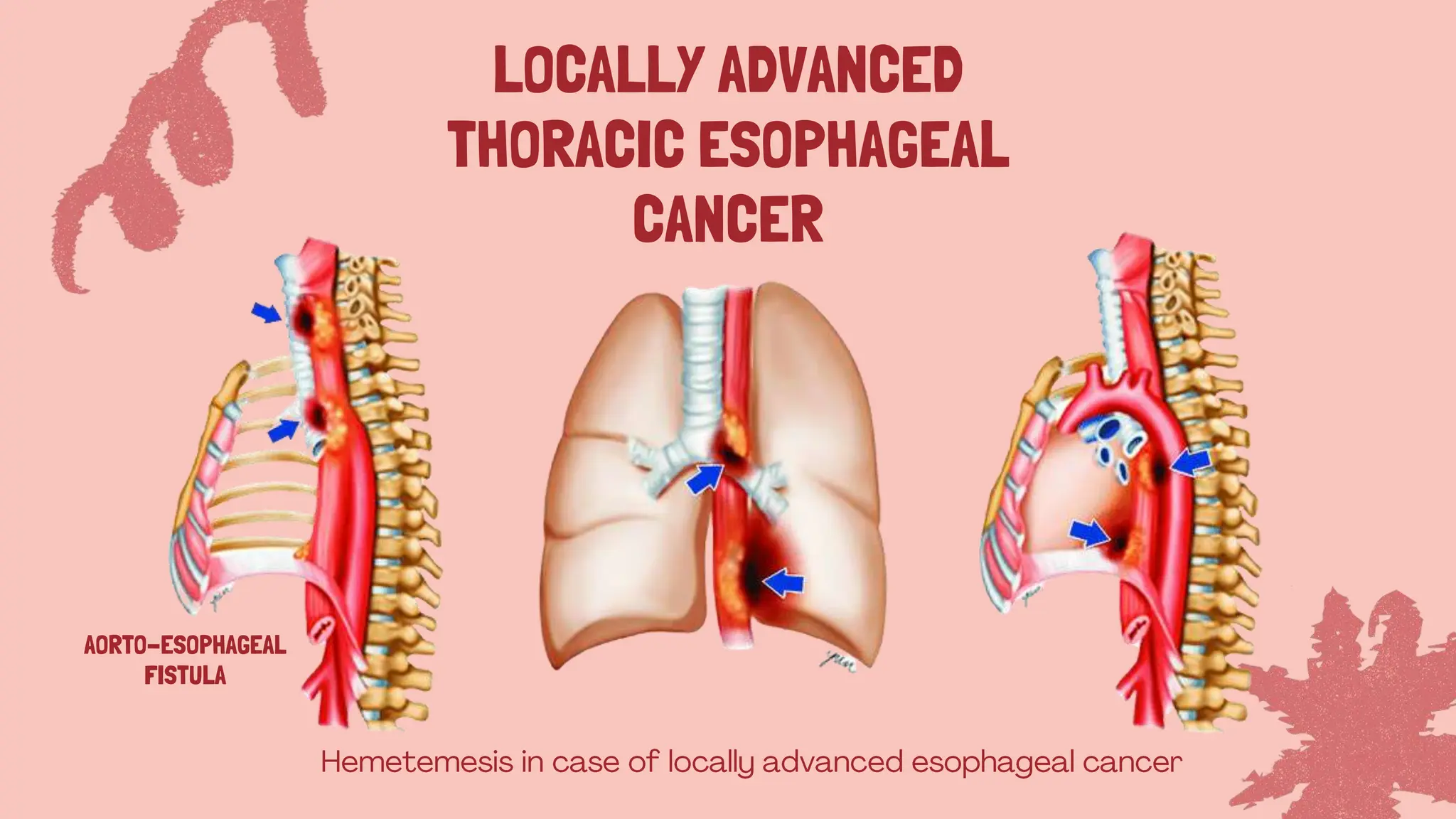 Anatomy of esophagus and GE junction: FALS 2024 | PPTX