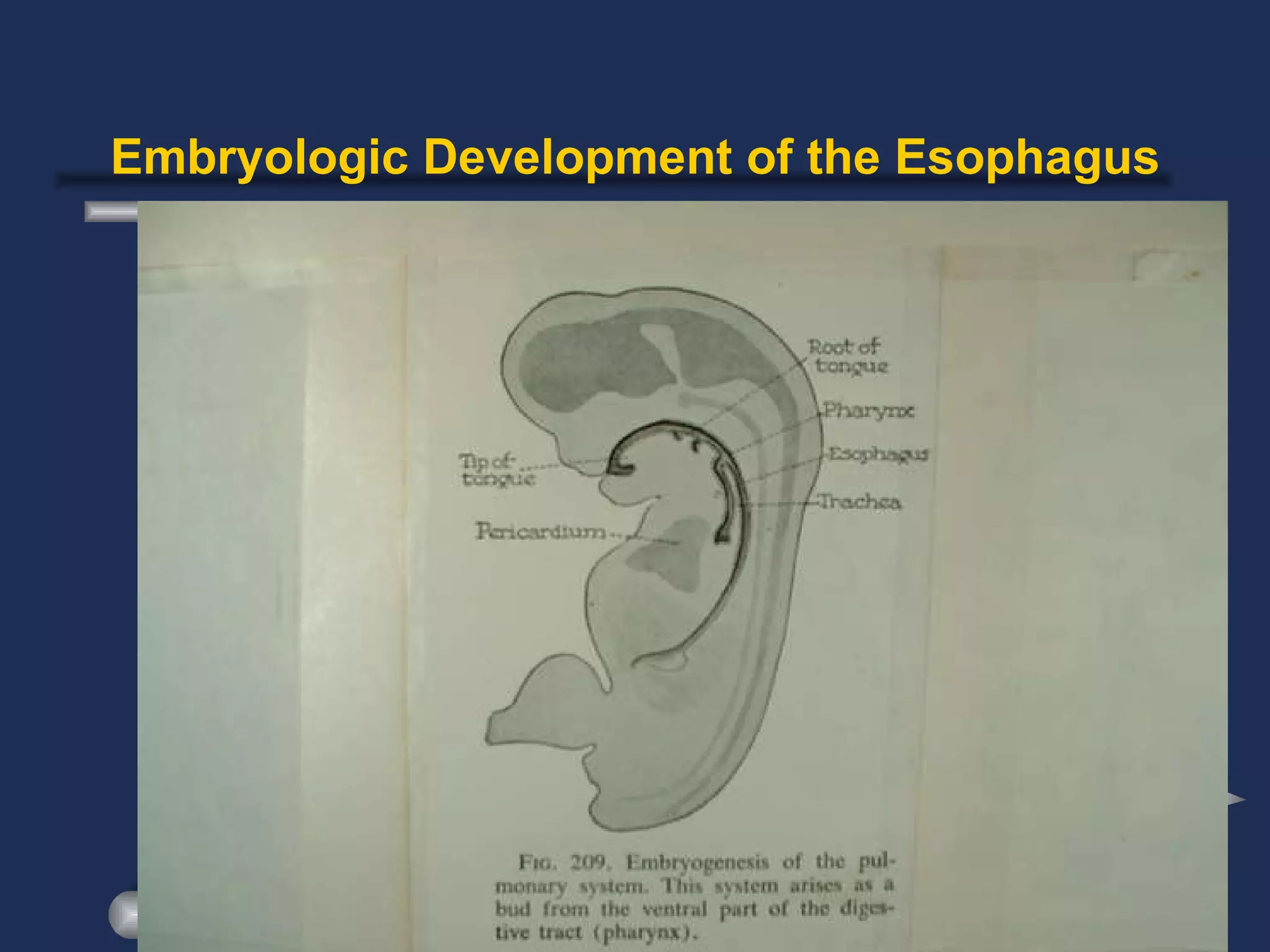 Esophagus Ppt Surgery Lect#2 | PPT