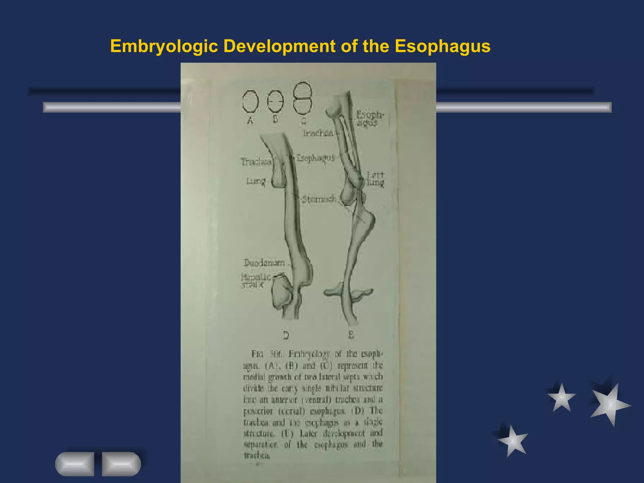 Esophagus Ppt Surgery Lect#2 | PPT