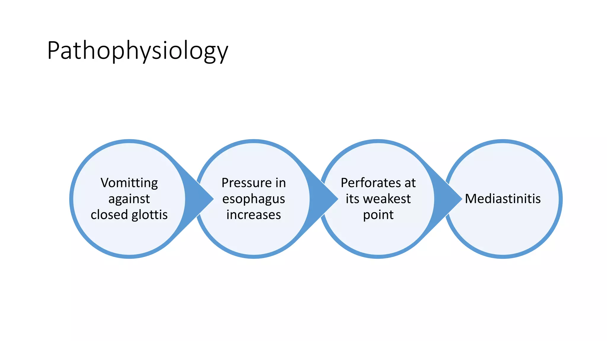 esophagus (1).pptx | Thyroid Disorders | Endocrine and Metabolic Diseases