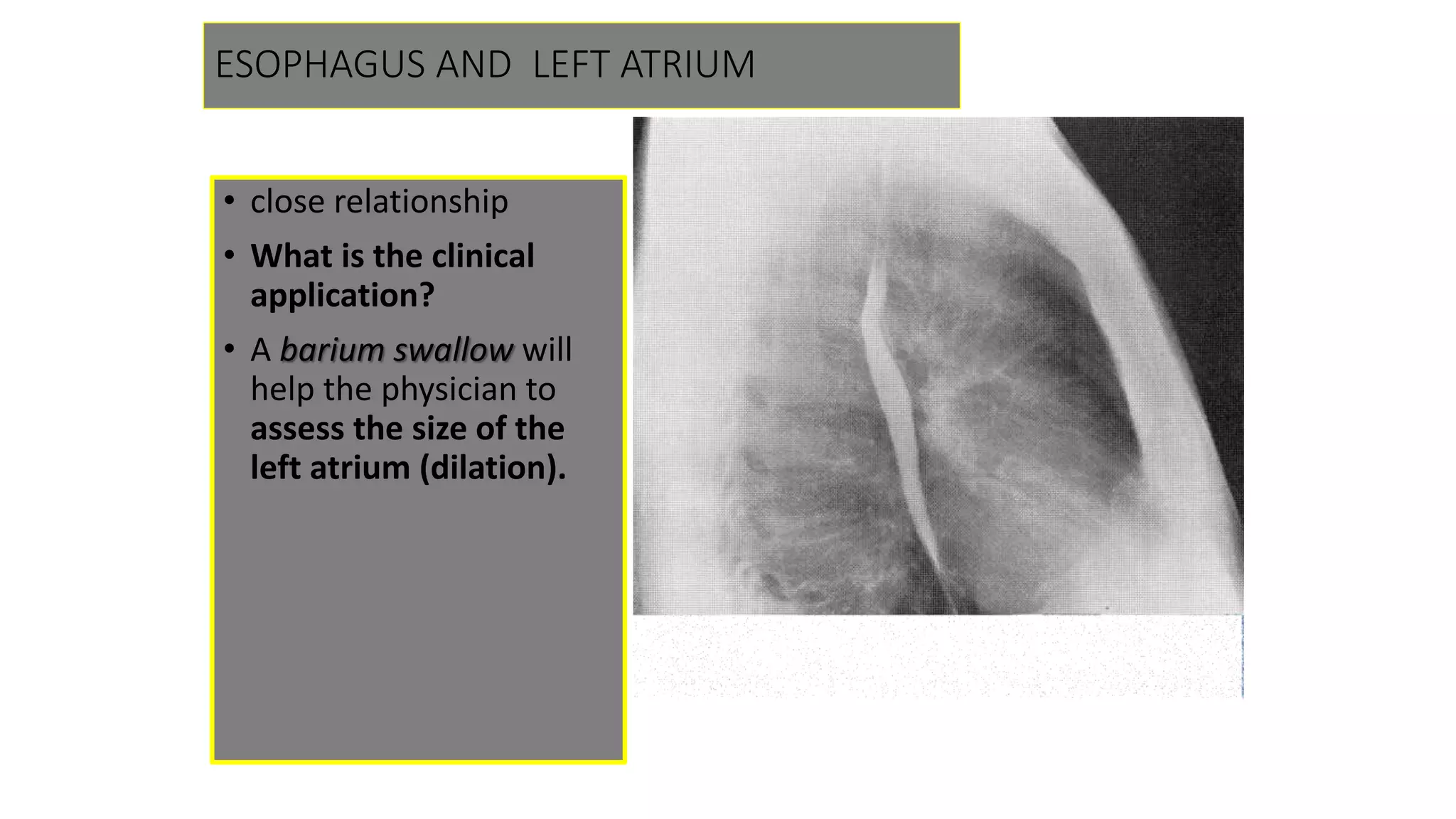 esophagus (1).pptx | Thyroid Disorders | Endocrine and Metabolic Diseases
