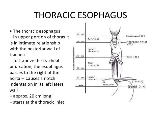 Esophagus & Diaphragmatic Hernia