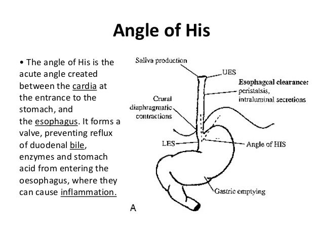 Esophagus & Diaphragmatic Hernia