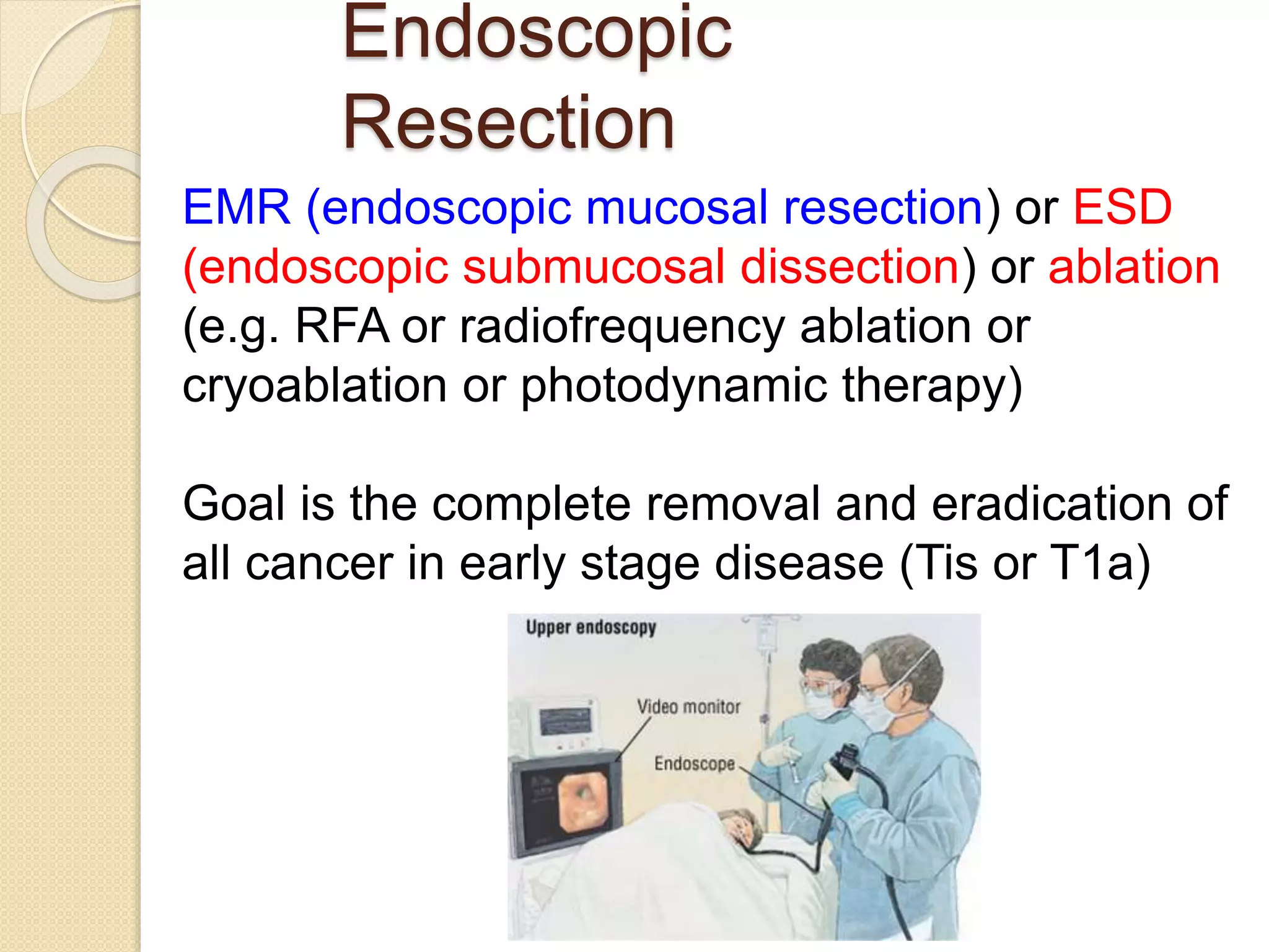 Treatment of Cancer of the Esophagus | PPTX