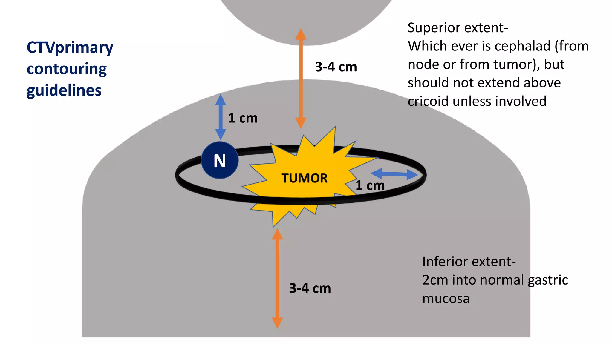 Esophagus Contouring.pptx | Medical Health