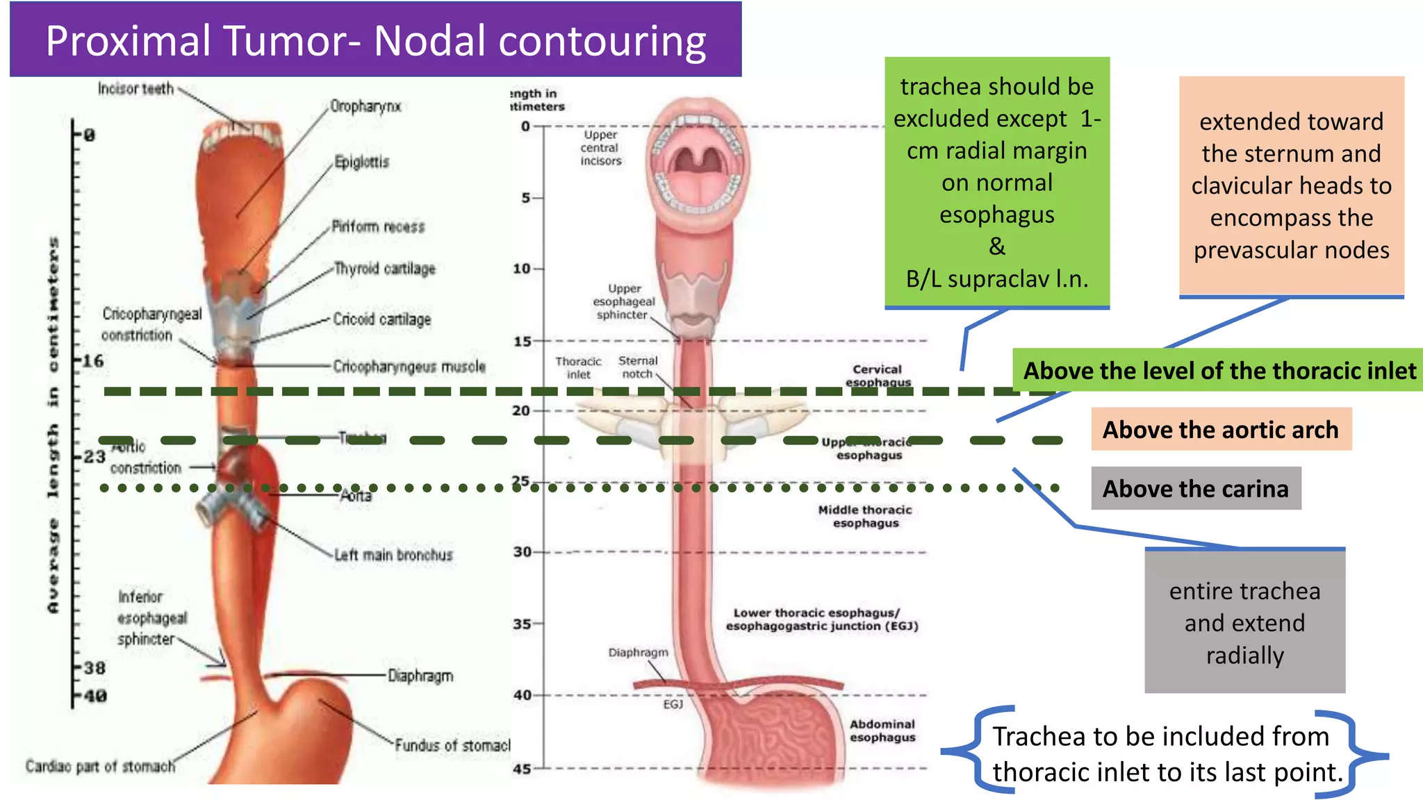 Esophagus Contouring.pptx