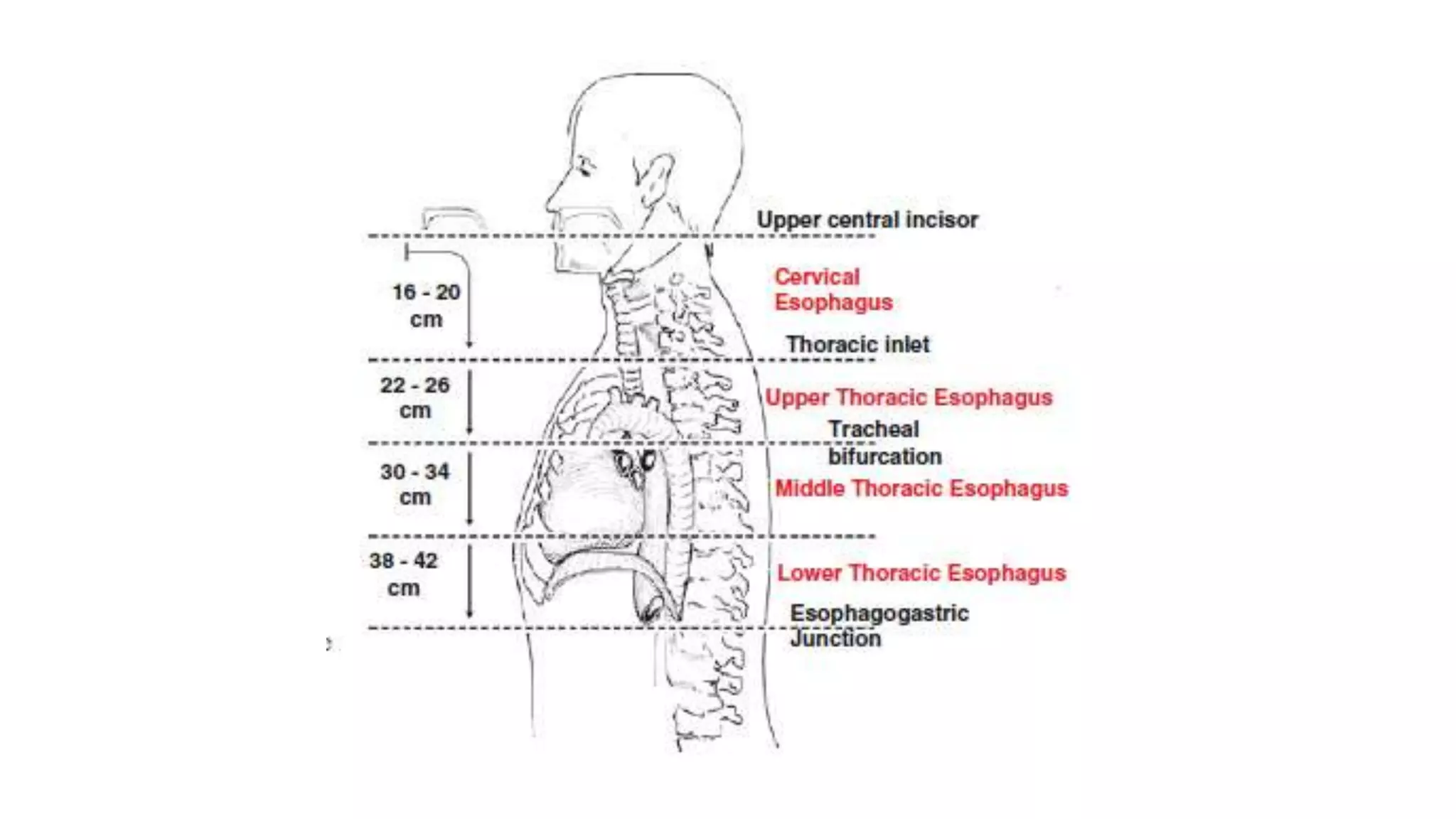 Esophagus Contouring.pptx