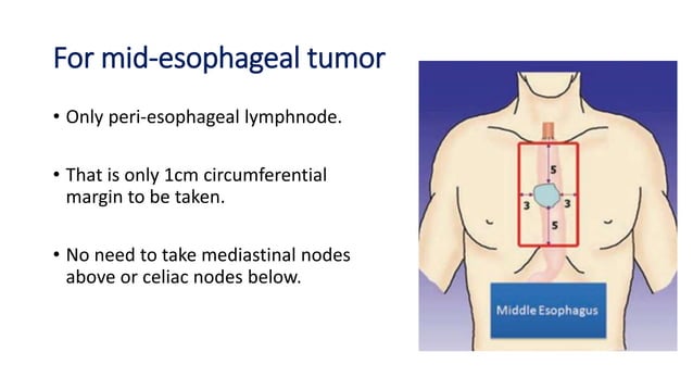 Esophagus Contouring.pptx | Medical Health