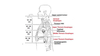 Esophagus Contouring.pptx