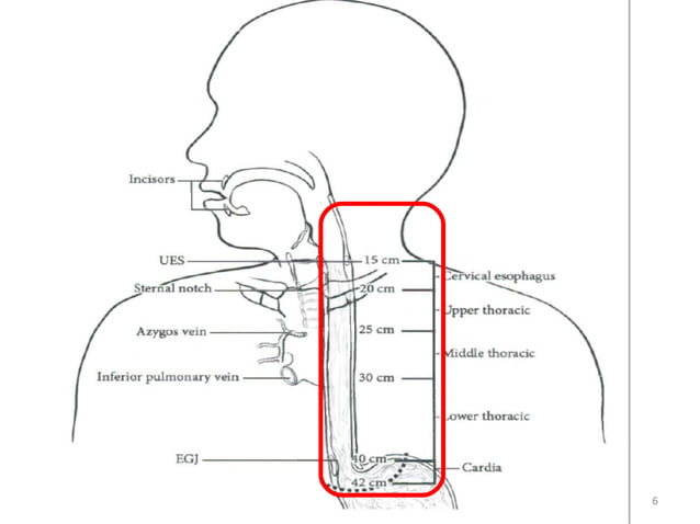 TARGET DELINEATION OF CANCER ESOPHAGUS | PPT