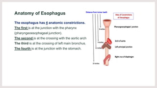 Esophagus ppt [Autosaved] [Autosaved].ppt