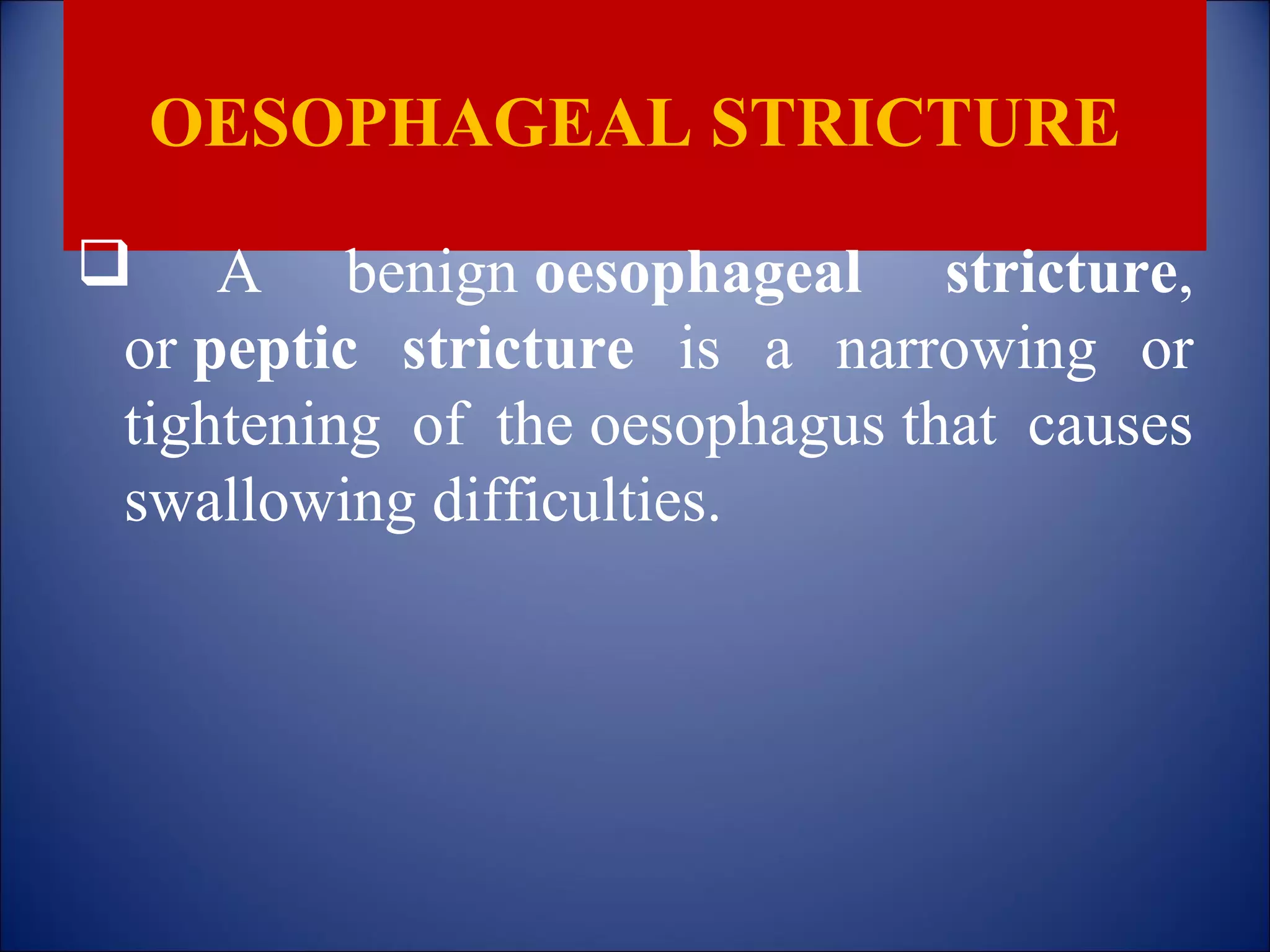 Esophagus stricture | PPT