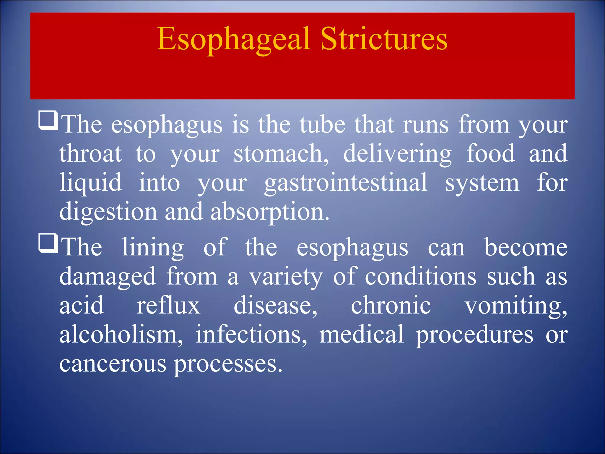 Esophagus stricture | PPT