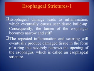 Esophagus stricture | PPT